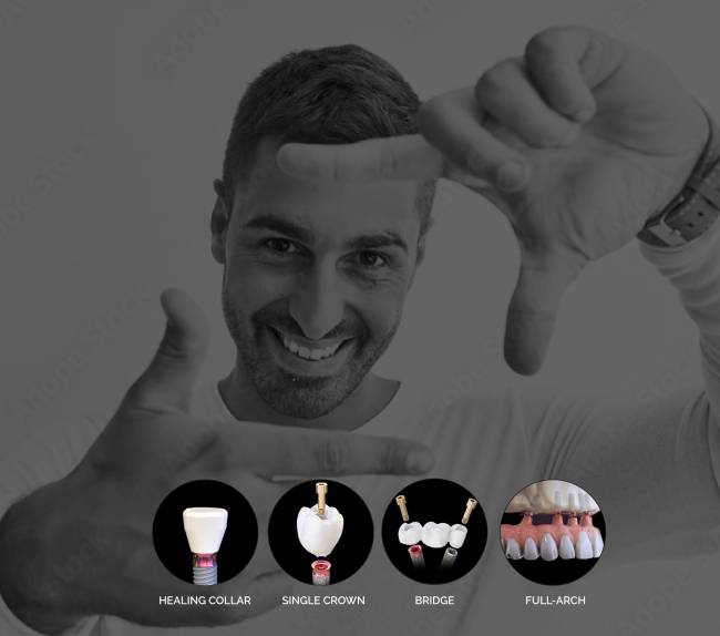 TRI Dental Implants: Start